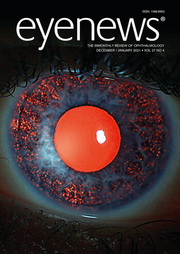 Eye News - print and online | Pinpoint Scotland