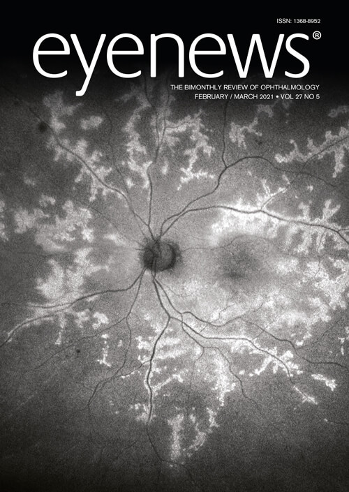 Eye News - print and online | Pinpoint Scotland