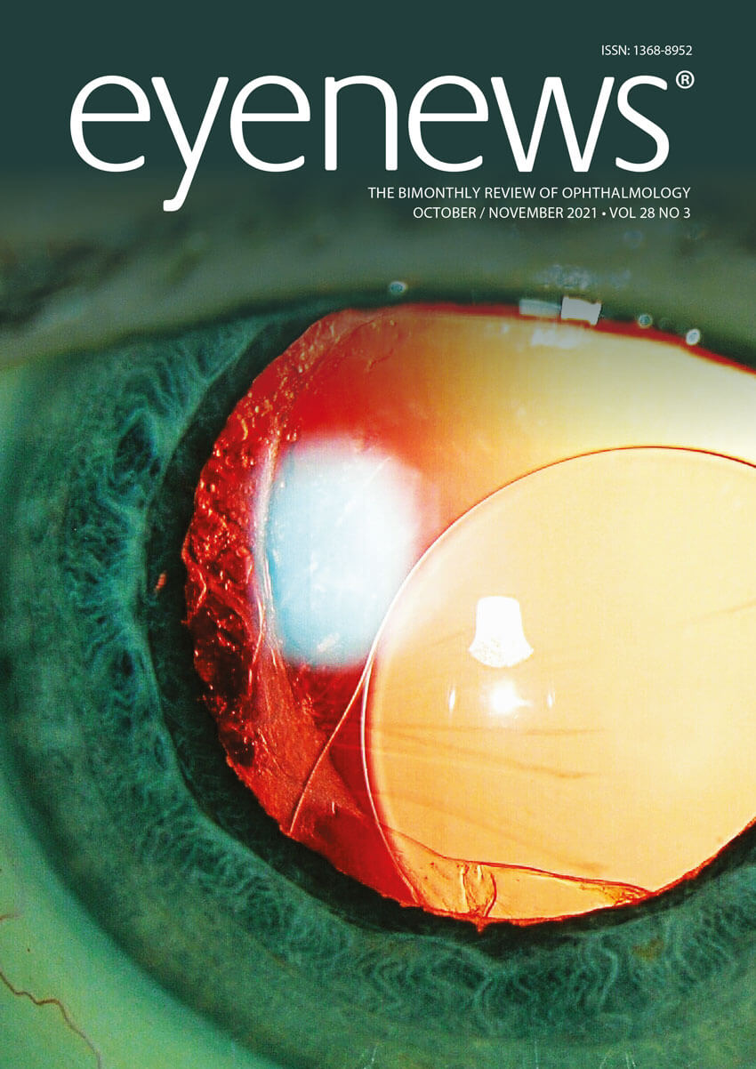 Eye News - print and online | Pinpoint Scotland