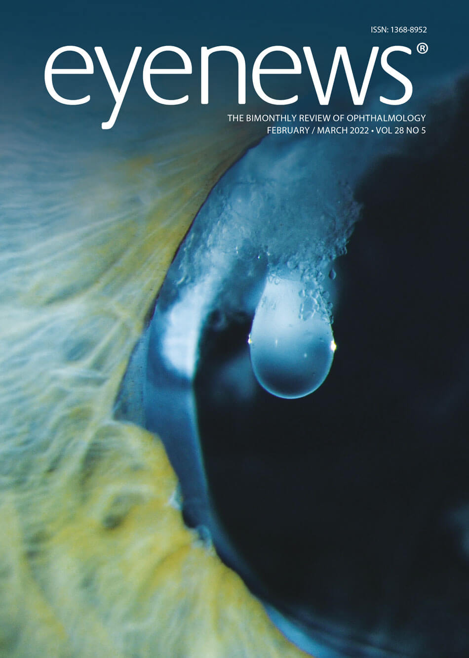 Eye News - print and online | Pinpoint Scotland