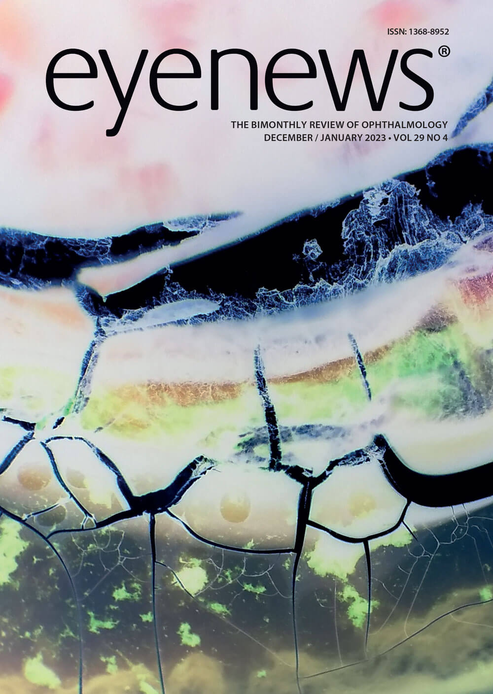 Eye News - print and online | Pinpoint Scotland