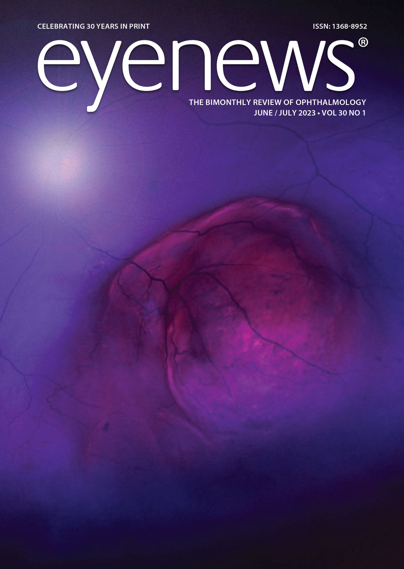 Eye News - print and online | Pinpoint Scotland