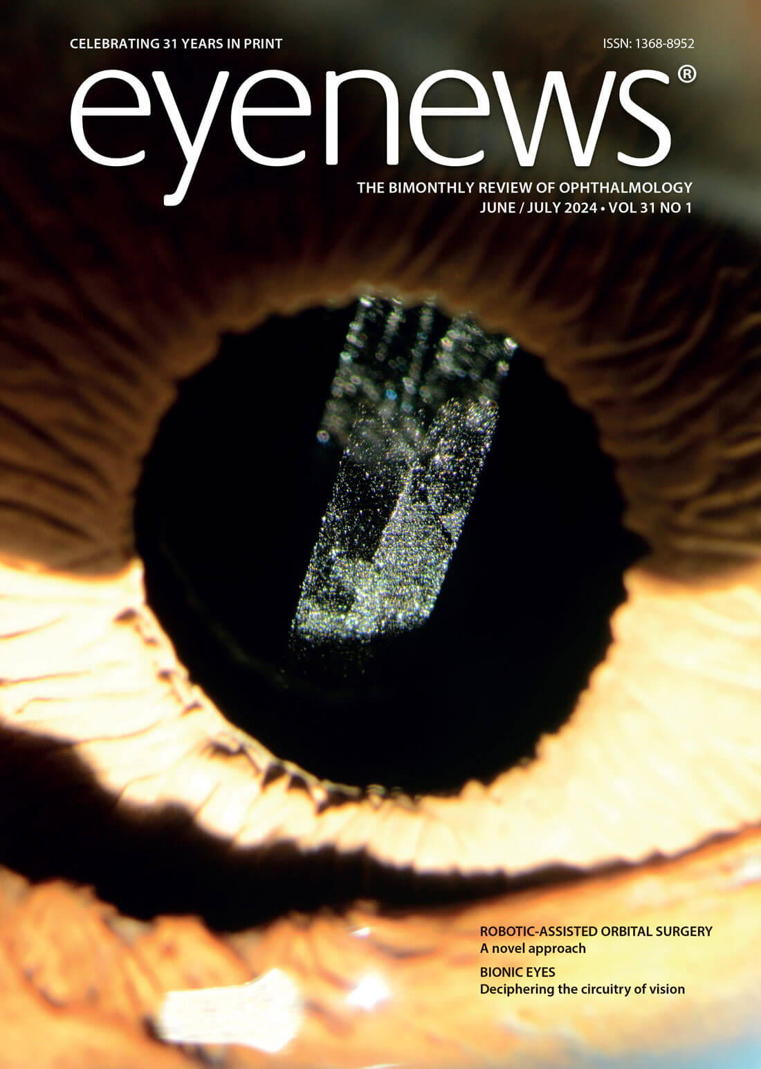 Eye News - print and online | Pinpoint Scotland